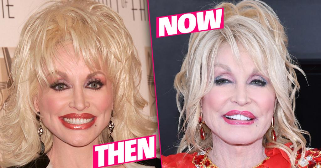 Dolly Parton's Plastic Face Fiasco Revealed In Shocking New Photos