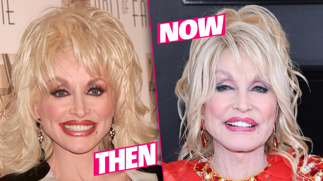 Dolly Parton's Plastic Face Fiasco Revealed In Shocking New Photos