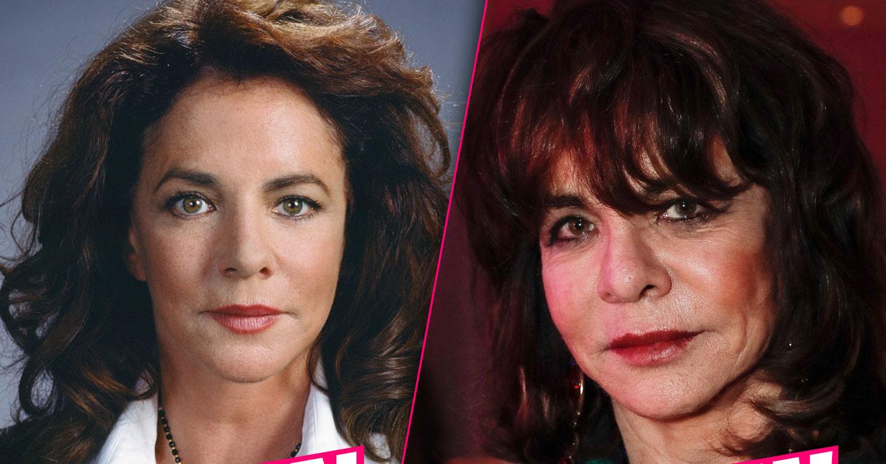 Stockard Channing Plastic Surgery Nightmare Exposed By Cosmetic Doctors