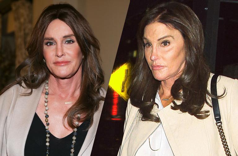 Facelifts! Botox! Stars With Freaky Faces After Botched Plastic Surgery ...