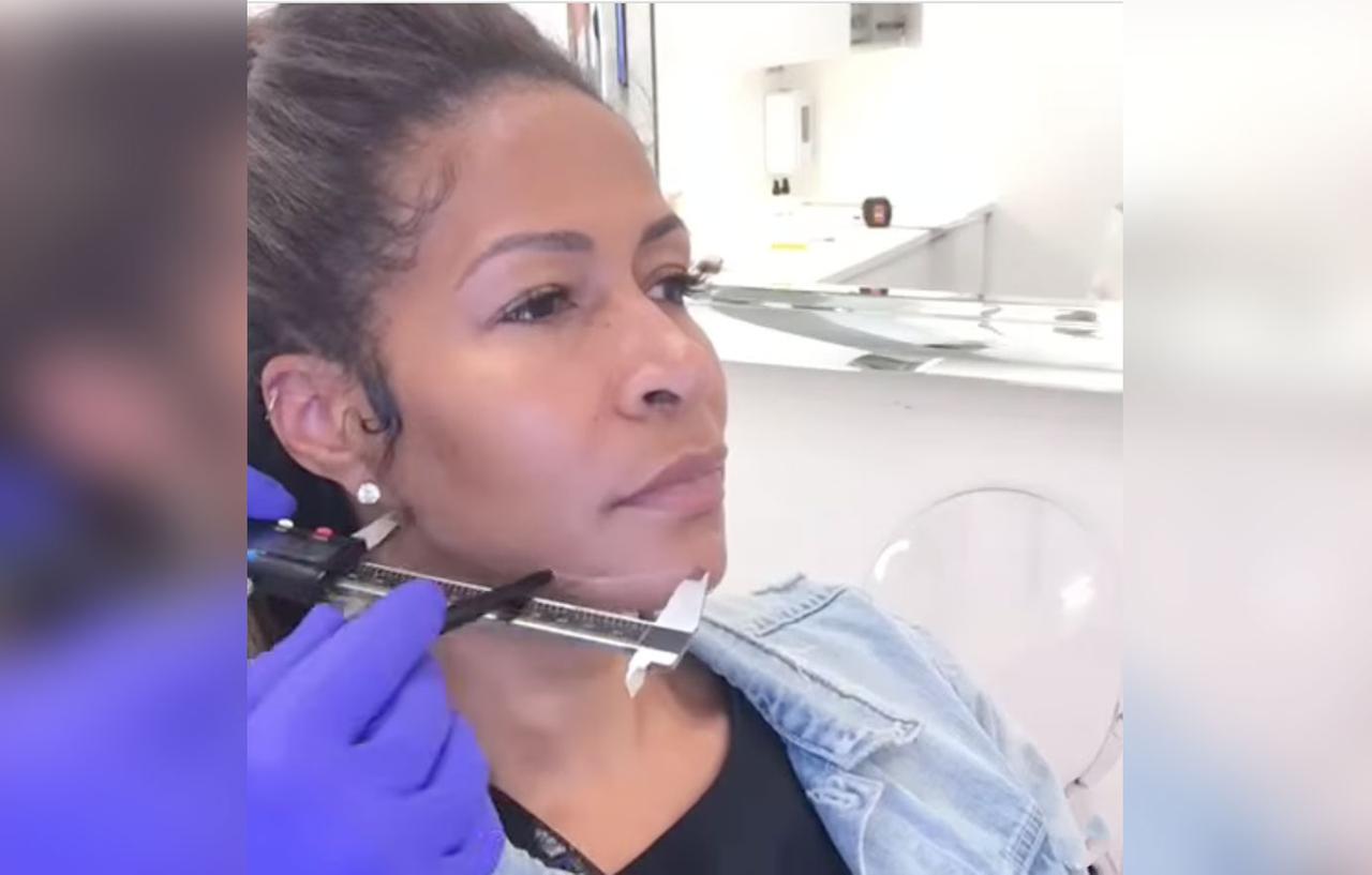 'RHOA' Alum Shereé Whitfield Caught Getting Work Done On Face Before ...