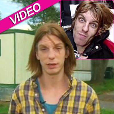 Bath Salts Terror: Former Addict Describes Horror Of The Drug Behind ...