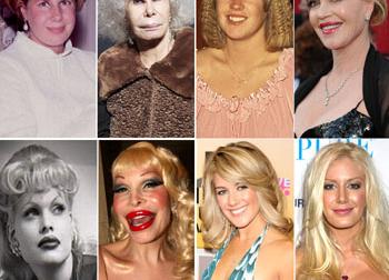 What Happened To Your Face? The 10 Most Shocking Plastic Surgery ...