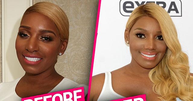 NeNe Leakes Confesses She Went Under The Knife For ANOTHER Nose Job