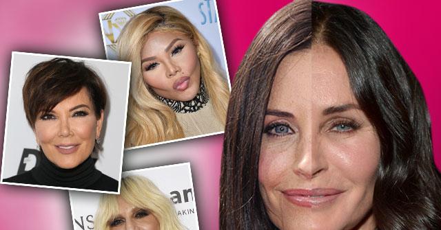 Facelifts! Botox! Stars With Freaky Faces After Botched Plastic Surgery ...