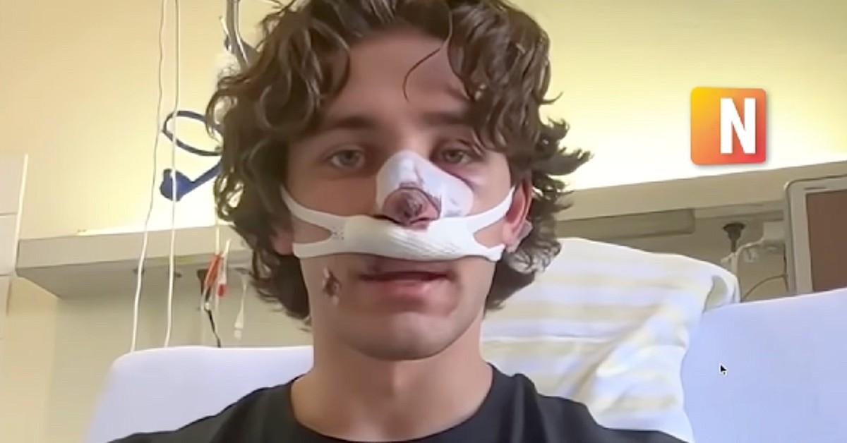 PHOTOS: Model Beaten While Defending Women From 'Illegal Migrant'