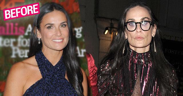 Fears For Demi! Moore Can't Hide Dramatic Weight Loss & Scary Skinny Face