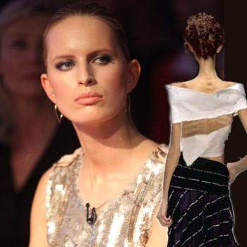 Karolina Kurkova Reveals Shocking Modeling Industry Weight Pressure