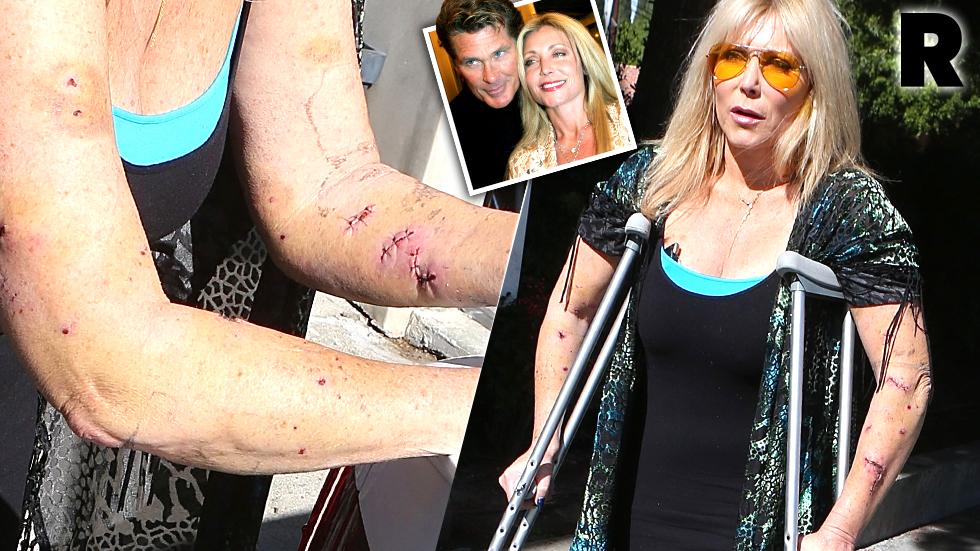 'Don't Let Me Die!' David Hasselhoff's Ex-Wife Opens Up About ...