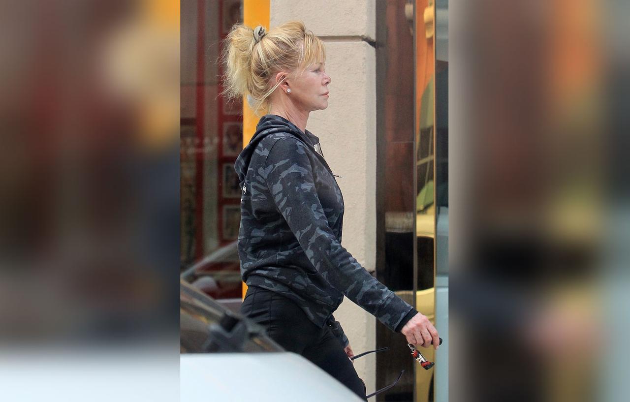 Melanie Griffith Wears Nose Bandage After Skin Cancer Treatment