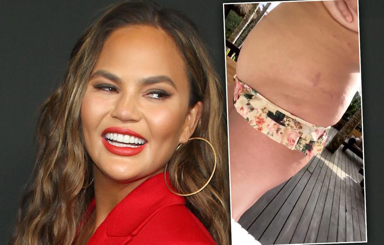 Celebrities Who Are Unafraid To Share Unaltered Body Photos