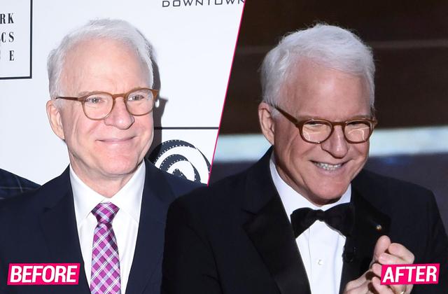 Plastic Surgeons Reveal Steve Martin's Secrets To Youthful Look